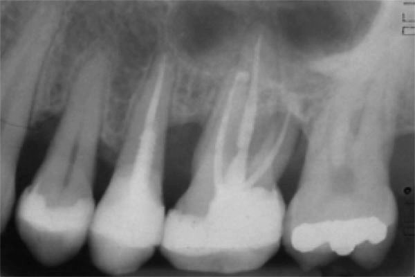 © Klinik für Oralchirurgie und Stomatologie, Zahnmedizinische Kliniken ...