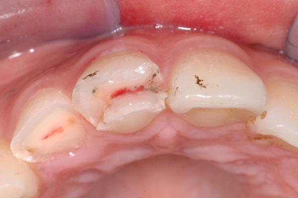 © Klinik für Oralchirurgie und Stomatologie, Zahnmedizinische Kliniken ...